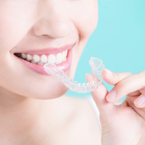 Aligner – unsichtbare Zahnschiene